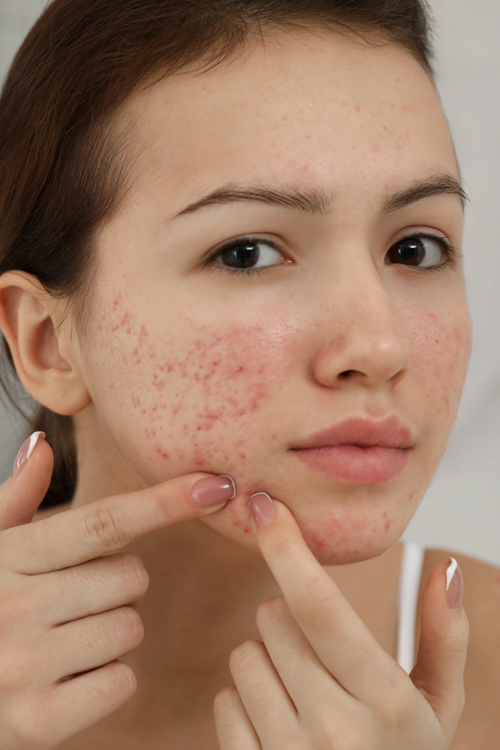 20 Most Epic Clear Skin Tips You Need To Know Right Now!