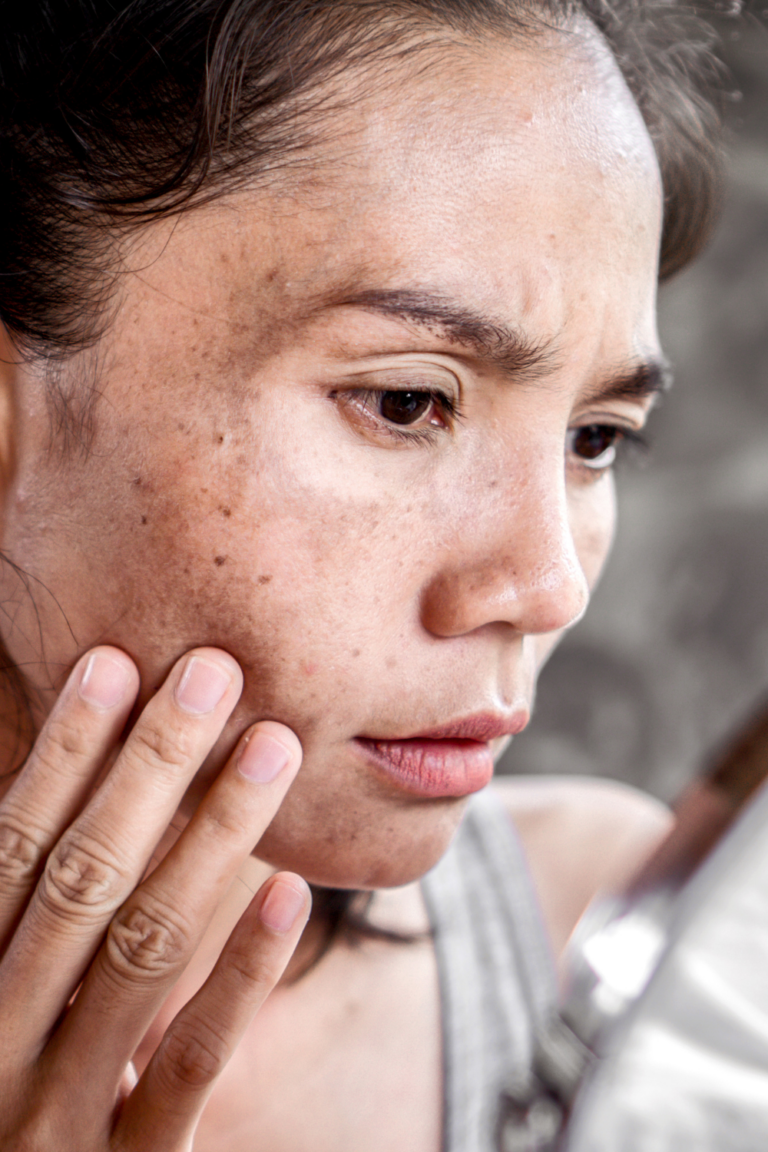 20 Most Epic Clear Skin Tips You Need To Know Right Now!