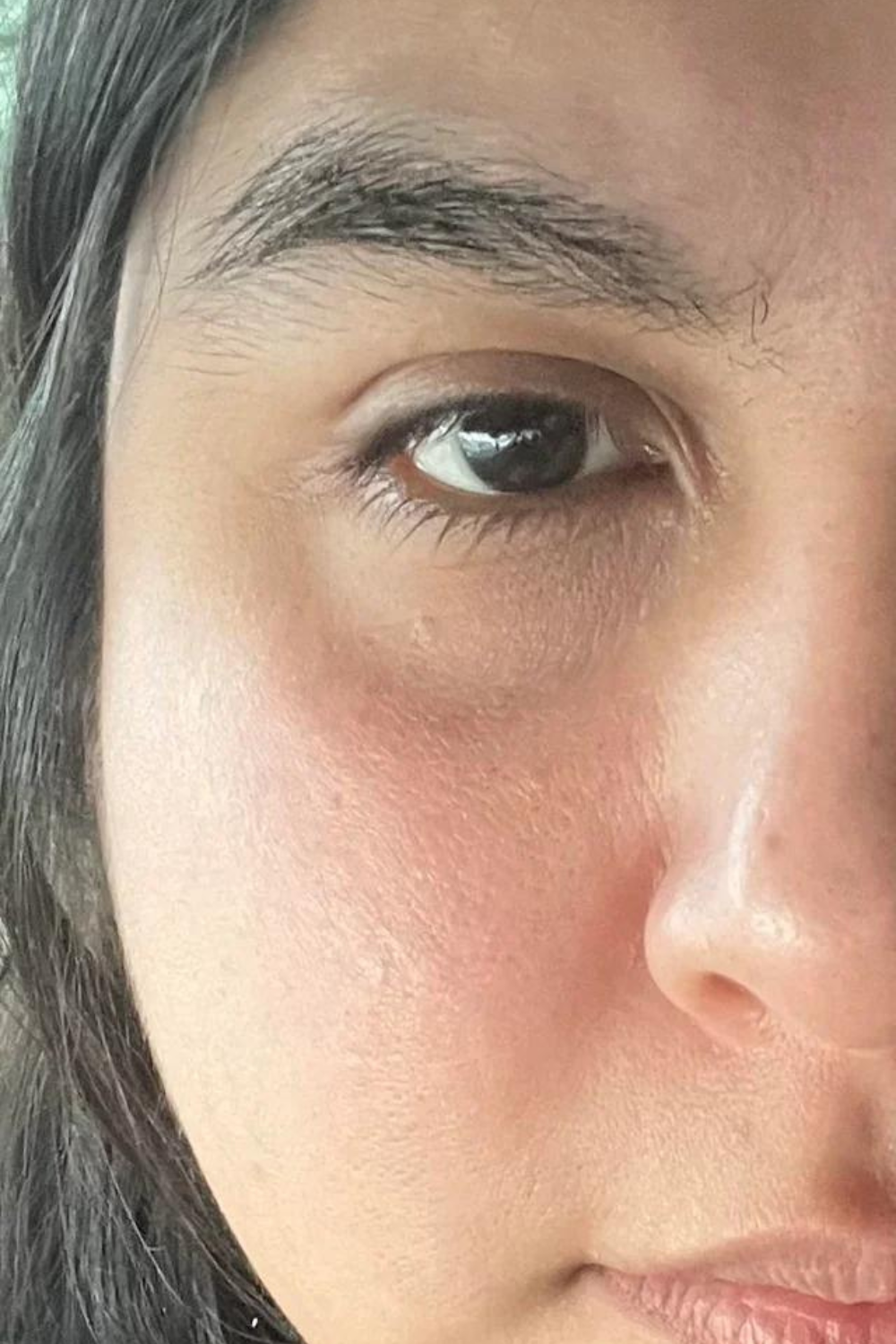 Tired Of Looking Tired? Here’s How To Get Rid Of Dark Circles For Good