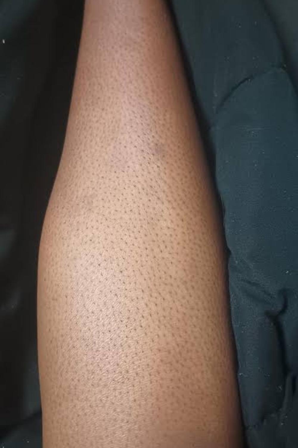 12 Things That Absolutely Changed The Way My Legs Look - Bye Bye ...