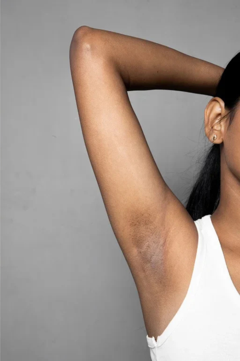 How To Get Rid Of Dark Underarms Like They Never Existed!