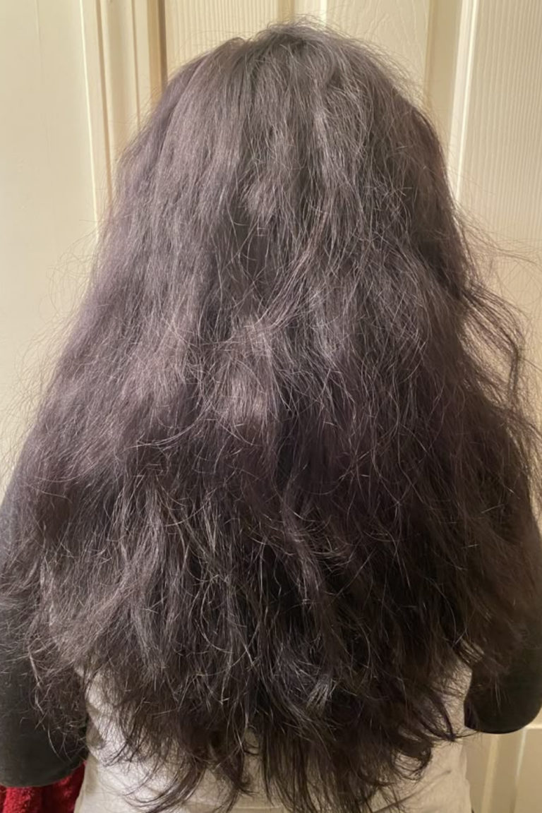 Straw-Like Strands? Try These 14 Dry Hair Remedies Before You Cry